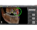 BIO | Max Implants » Shop Online | Blue Sky Bio